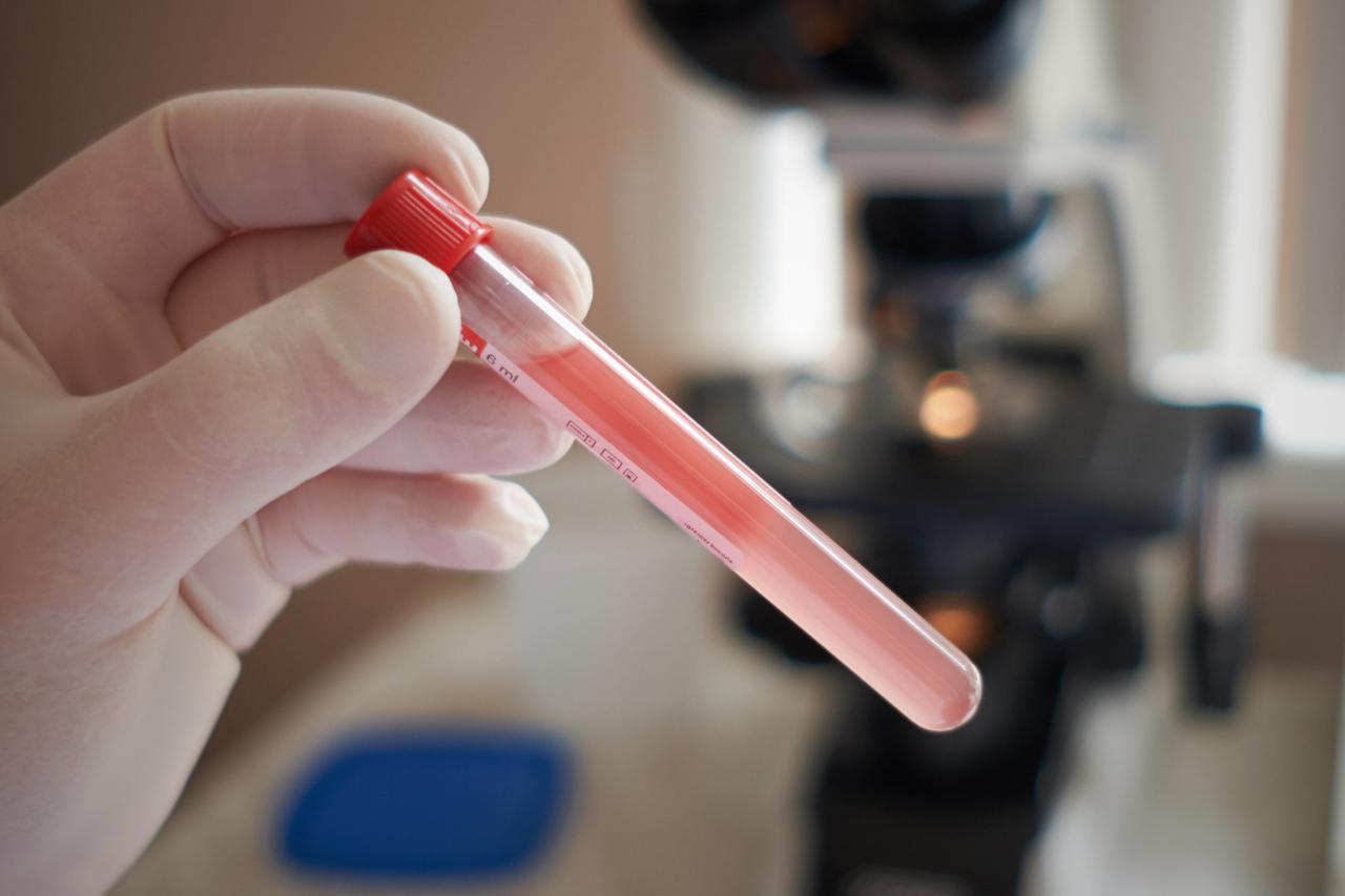 Mykoplasma: Manipulativ bakterie som kan undgå immunförsvaret – Natural ...